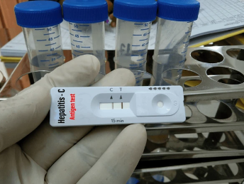 Ηπατίτιδα C: Τι πρέπει να γνωρίζετε για την πρόληψη και τη θεραπεία ...